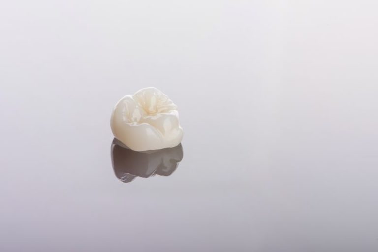 What to Do if You Lose a Dental Crown